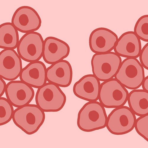 7 talks with insights on breast cancer | TED Talks