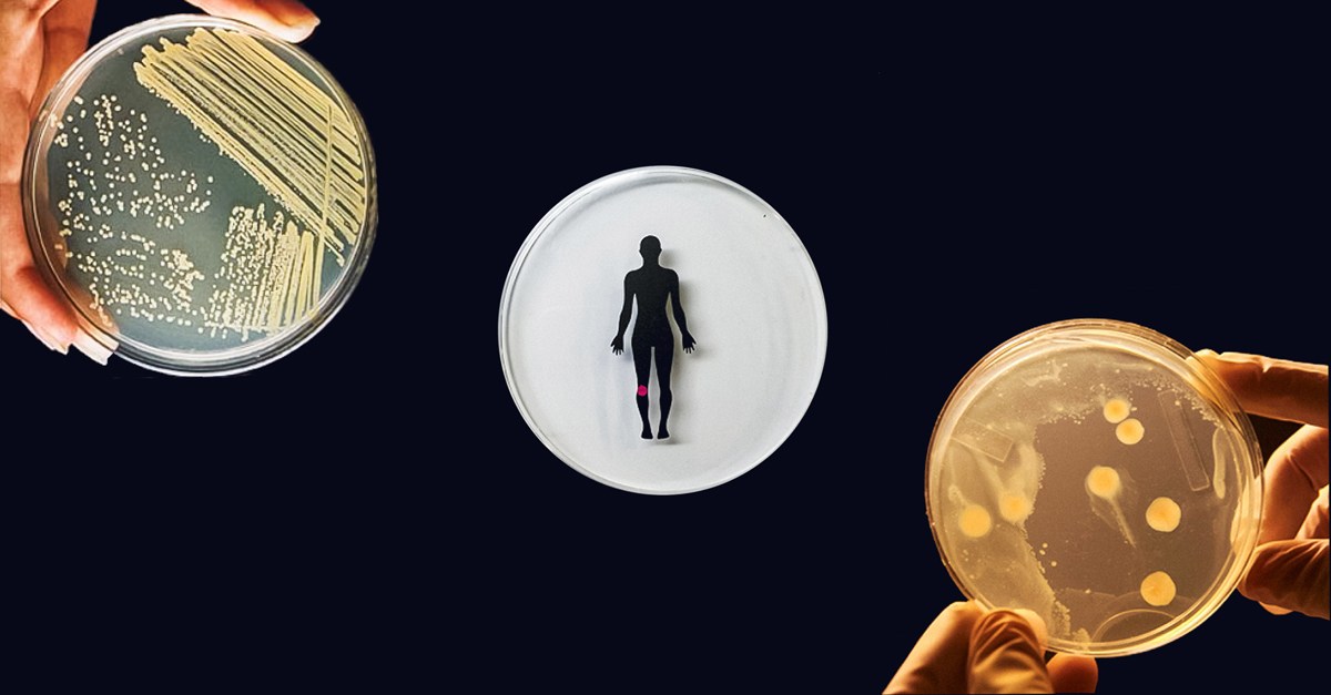 Biohacking: DIY science for everyone | TED Talks