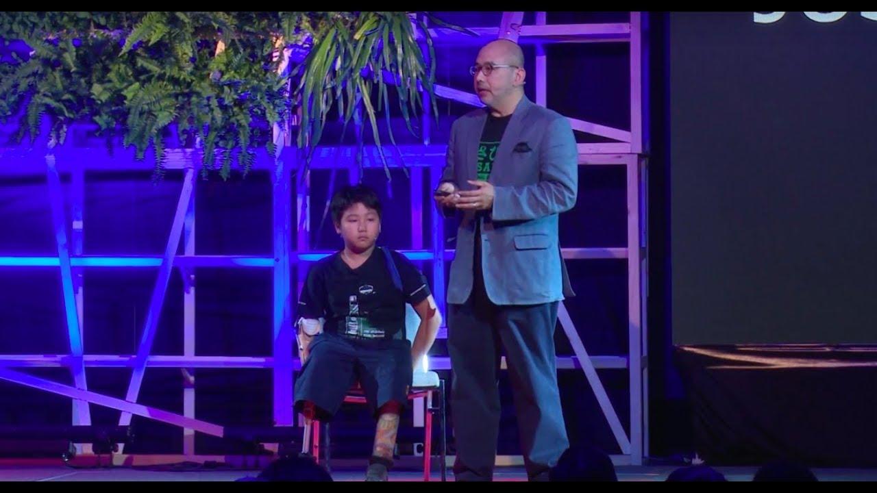 Water & Zy Kher Lee: Walking without Legs | TED Talk