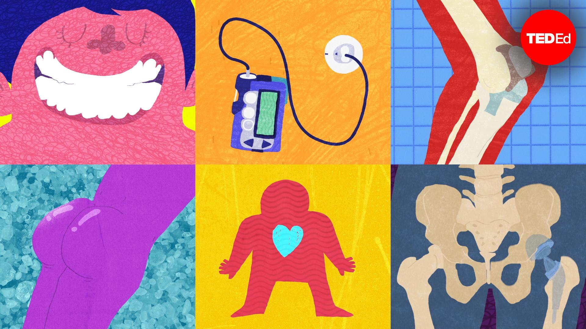 Kaitlyn Sadtler: Your body vs. implants | TED Talk