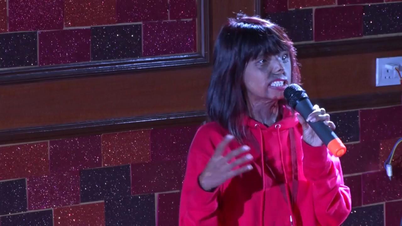 Anmol Rodriguez: The Story of a not so beautiful girl. | TED Talk