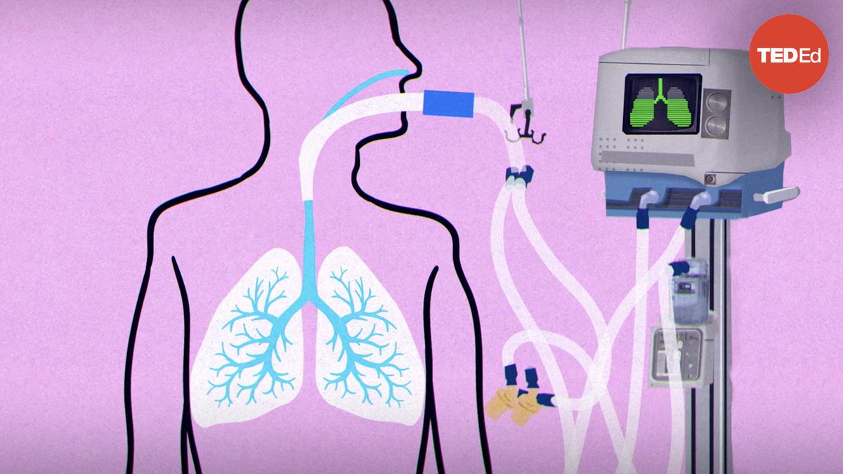 Alex Gendler: How do ventilators work? | TED Talk