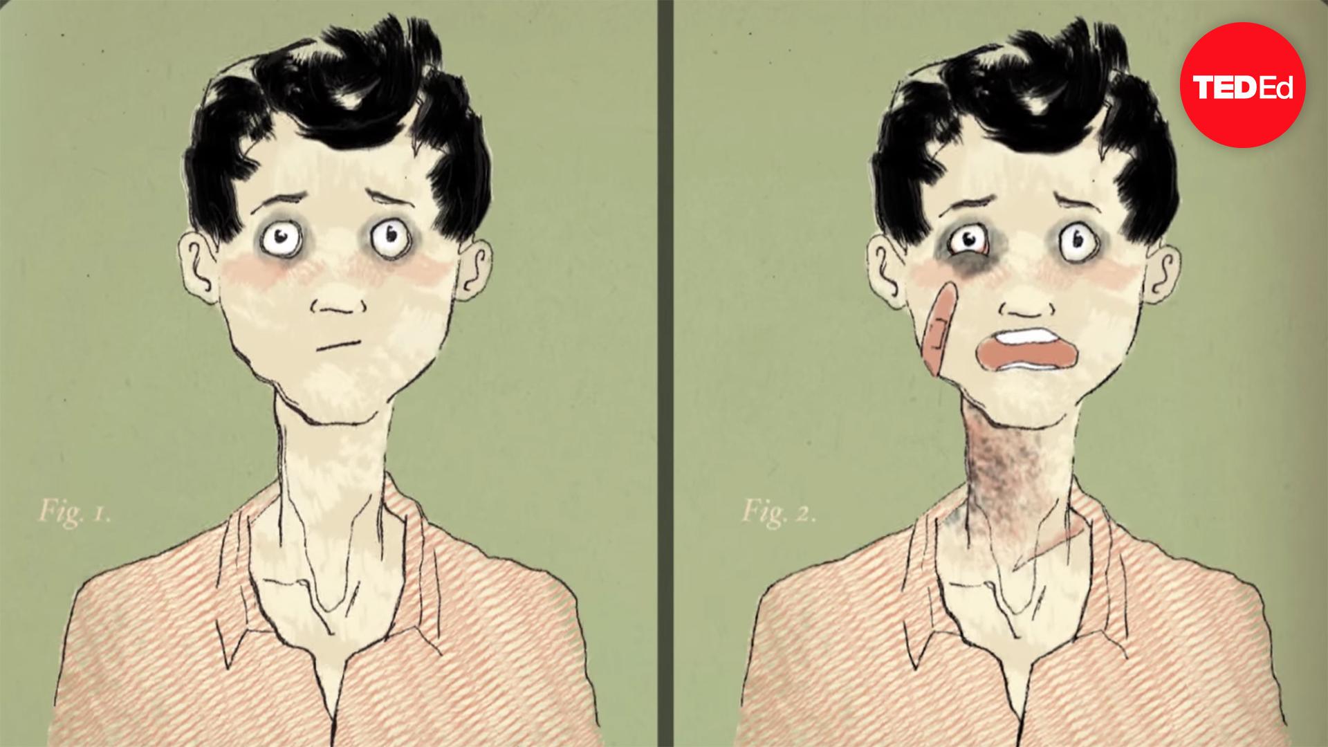 Joy Lin: If superpowers were real: Immortality | TED Talk