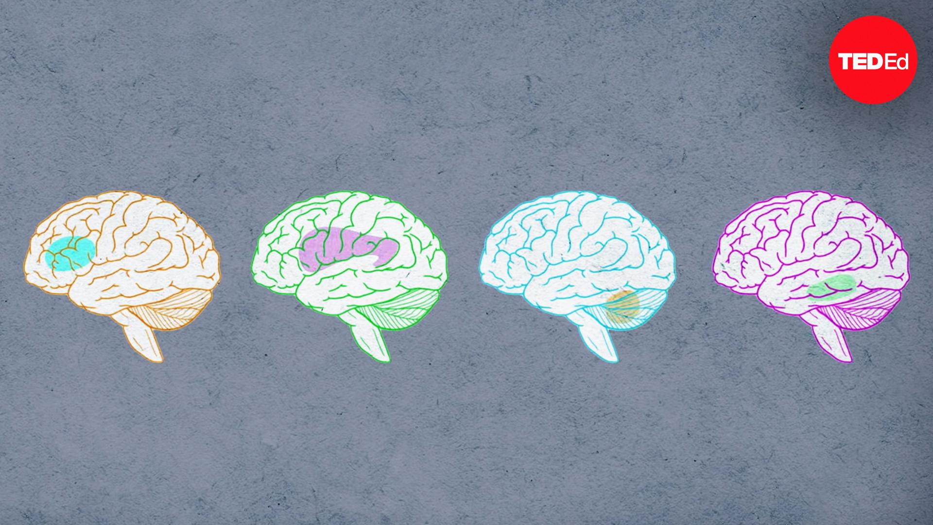 Kelli Sandman-Hurley: What is dyslexia? | TED Talk