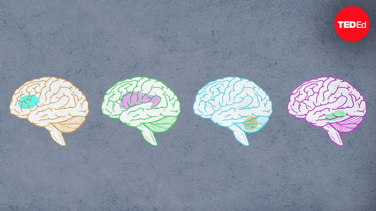 Kelli Sandman-Hurley: What is dyslexia? | TED Talk