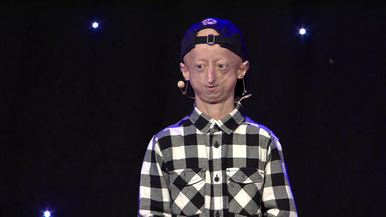 Michiel Vandeweert: Life's short, make the most of it | Michiel ...